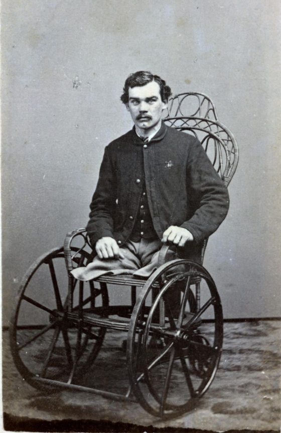 Amputations In Civil War: Horrible Photos Show How The Wounded Warriors ...