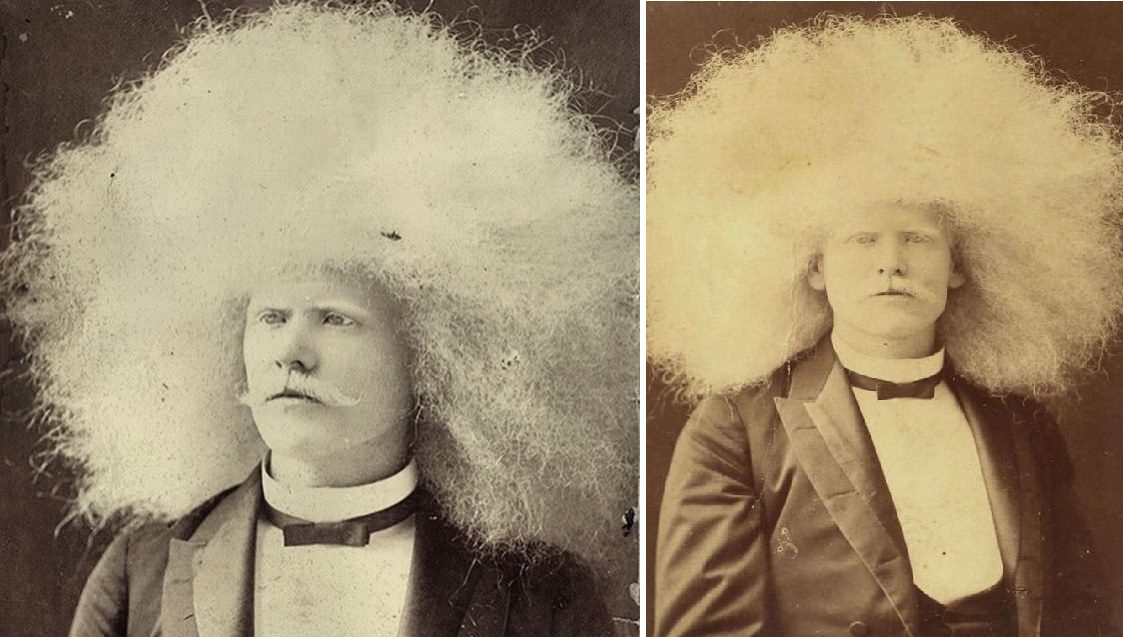 The Striking Story of Unzie: Australia's Albino Aborigine Man