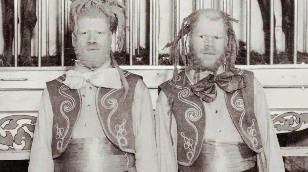 Tragedy to Stardom: The Harrowing Journey of the Kidnapped Muse Brothers
